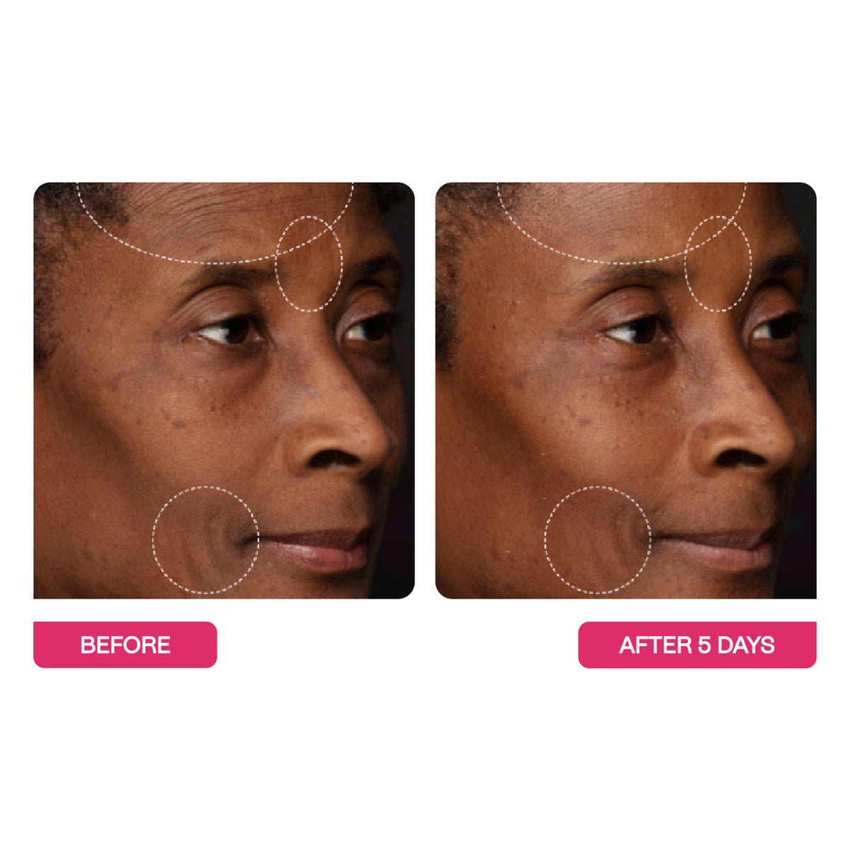 Wrinkle Relaxing Moisturizer – VIOLET GREY