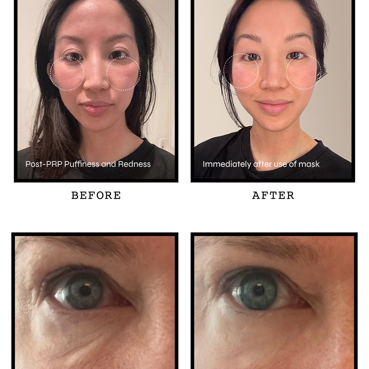 Damask Rose Revitalizing Gold-Infused Hydrogel Eye Masks – VIOLET GREY