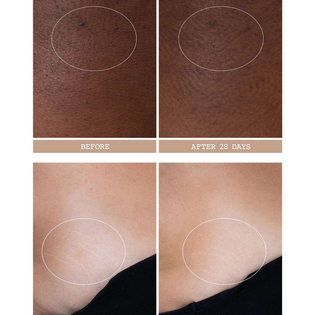 Body Reform Treatment Serum – VIOLET GREY